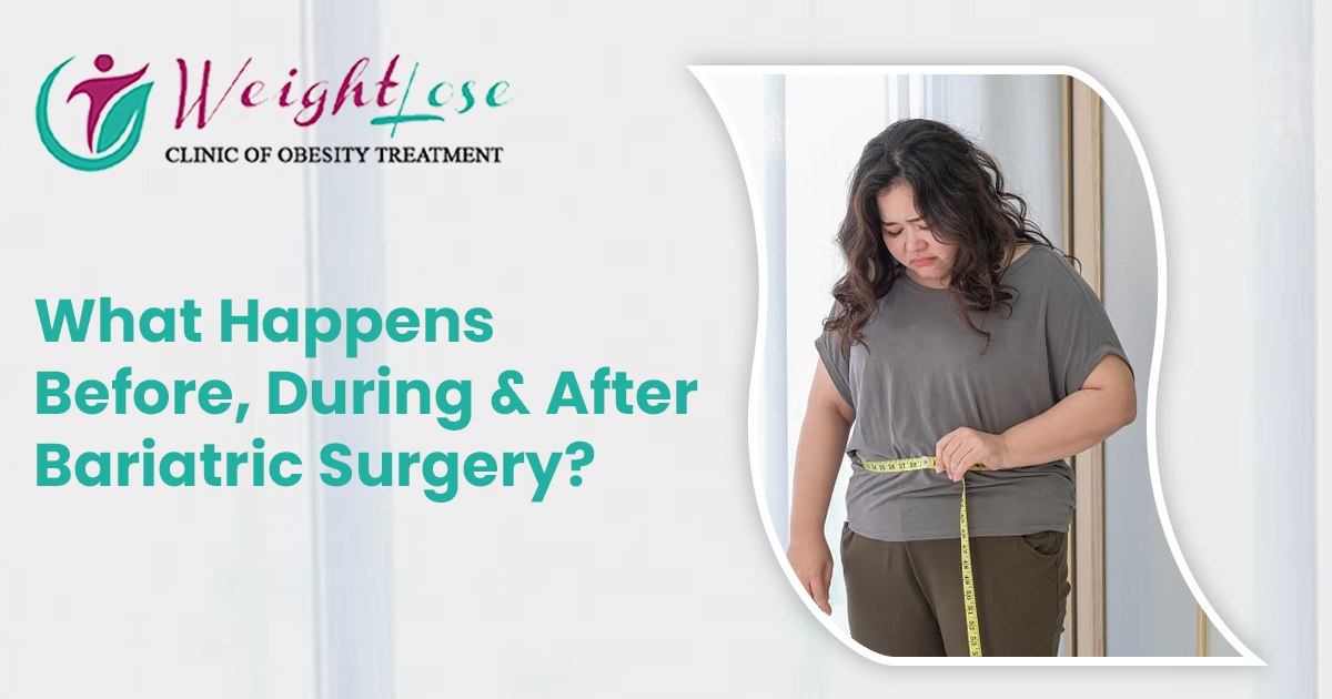What Happens Before, During & After Bariatric Surgery?